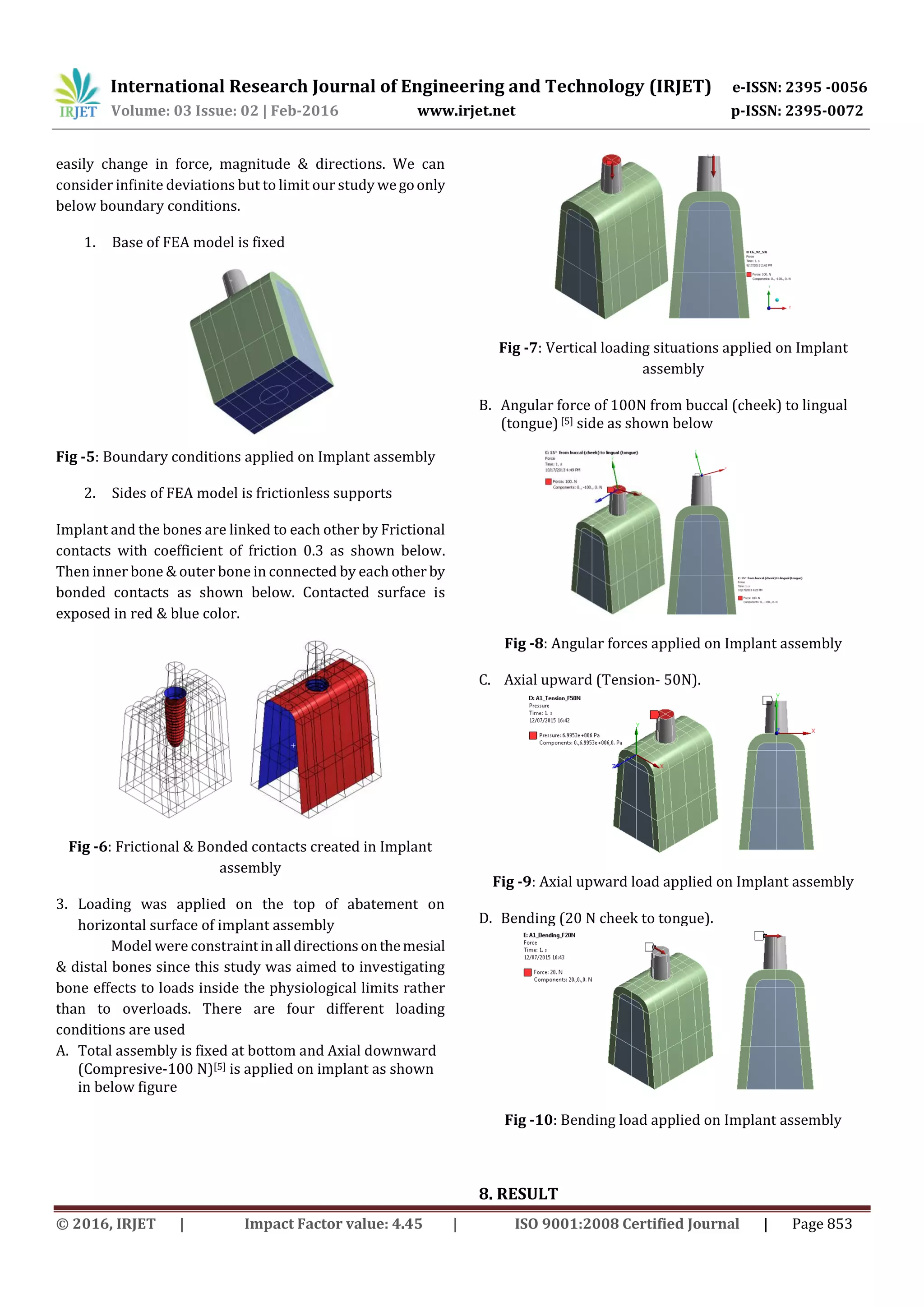 Application of finite element analysis to optimizing dental implant | PDF