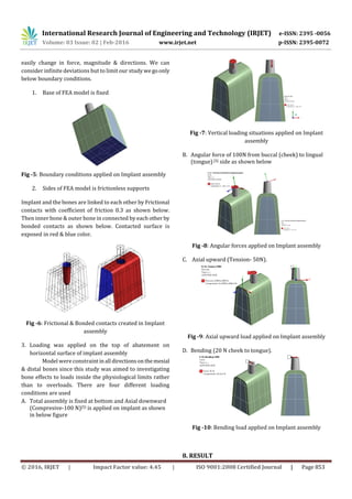 Application of finite element analysis to optimizing dental implant | PDF