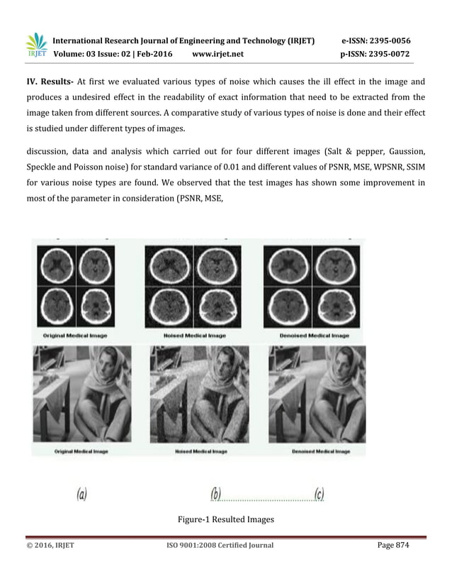 Implementation Of Noise Removal Methods Of Images Using Discrete Wavelet Transform And Filters Pdf