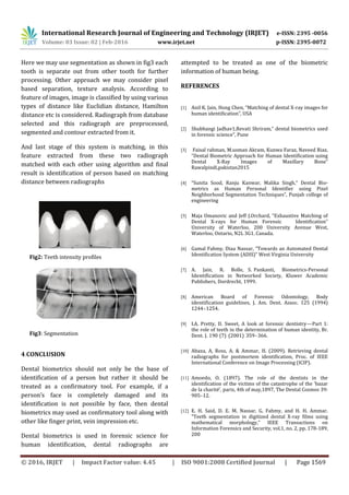 Dental Biometric Approach for Human Identification using Dental X-Ray Images of Maxillary Bone | PDF