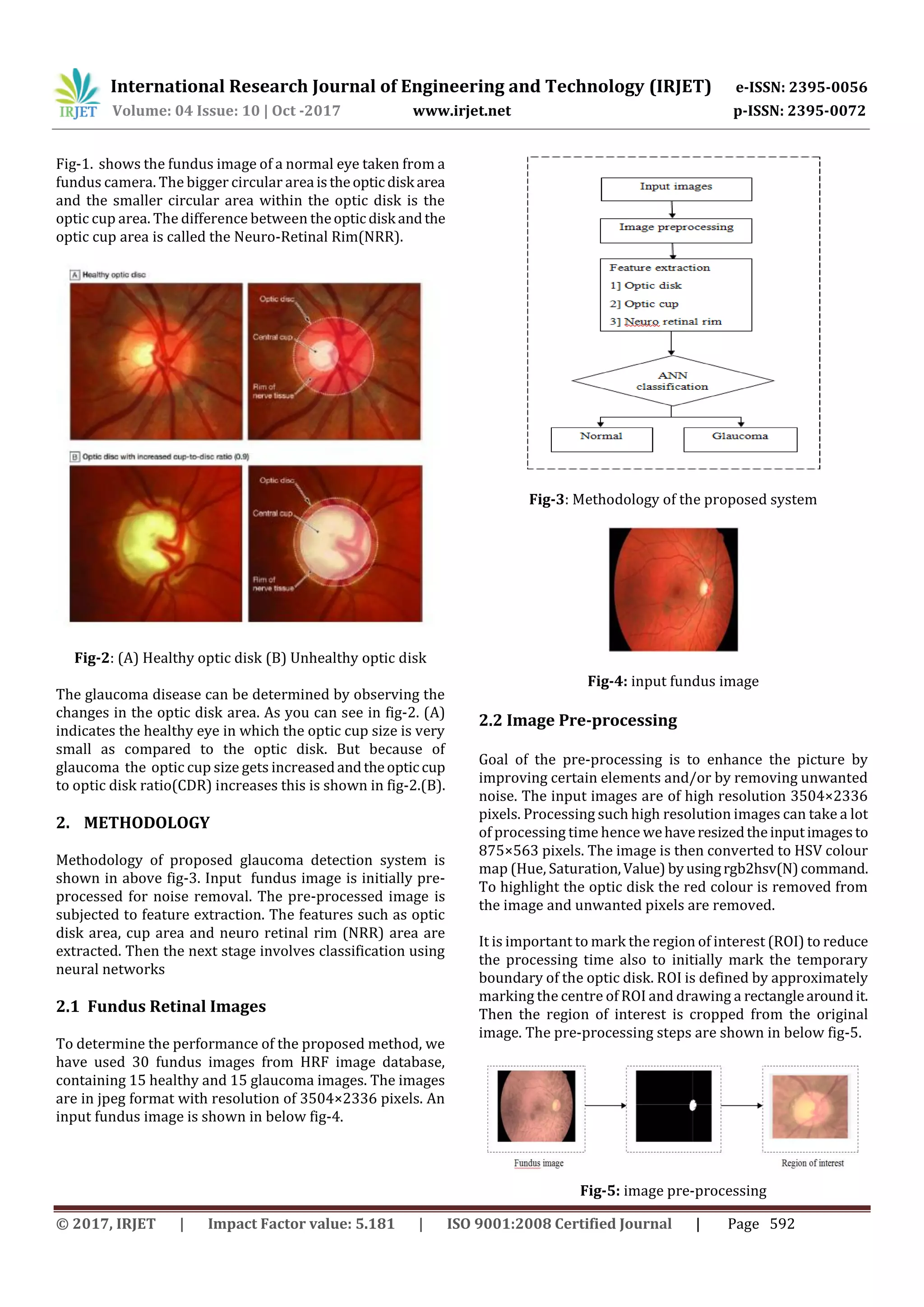 FPGA Implementation of Glaucoma Detection using Neural Networks | PDF FPGA Implementation of Glaucoma Detection using Neural Networks | PDF
