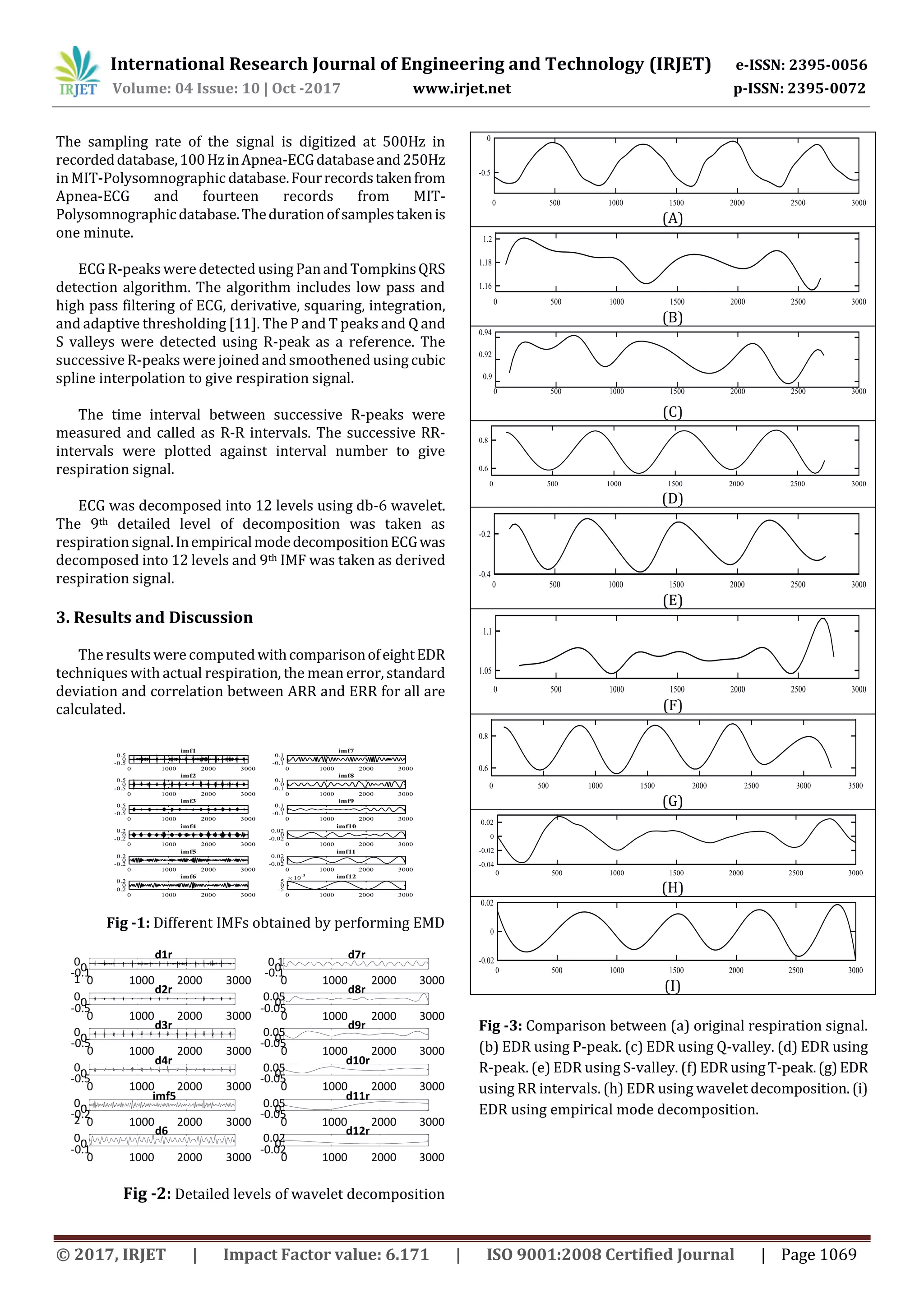 Reconstruction Of Respiratory Signal From Ecg Pdf Heart And Cardiovascular Diseases
