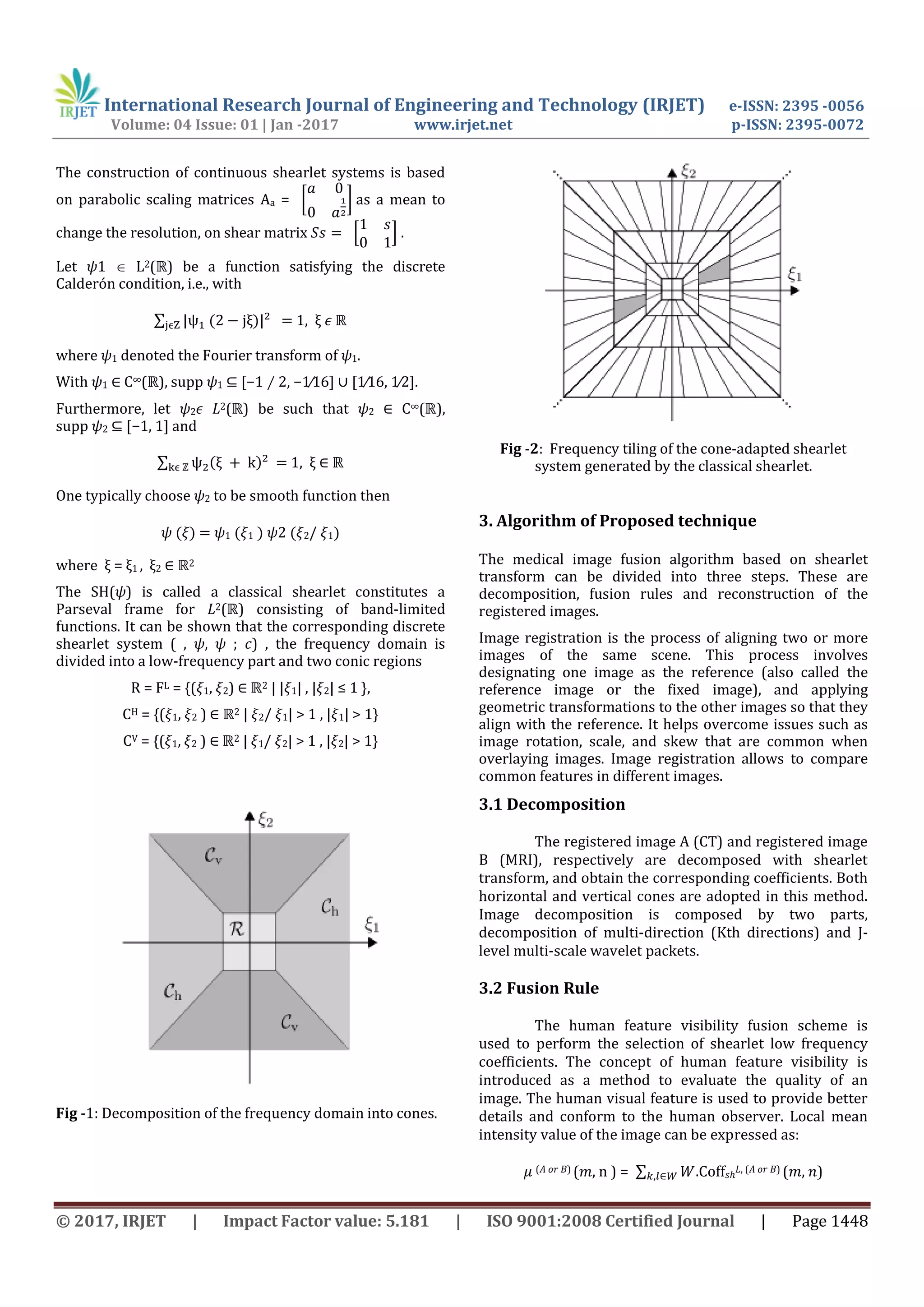 Review on Medical Image Fusion using Shearlet Transform | PDF