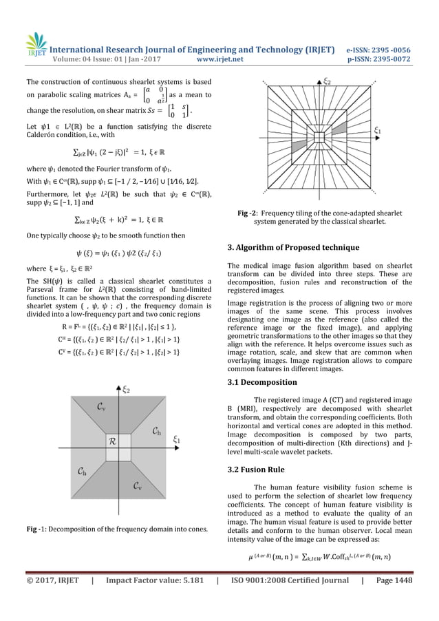 Review on Medical Image Fusion using Shearlet Transform | PDF