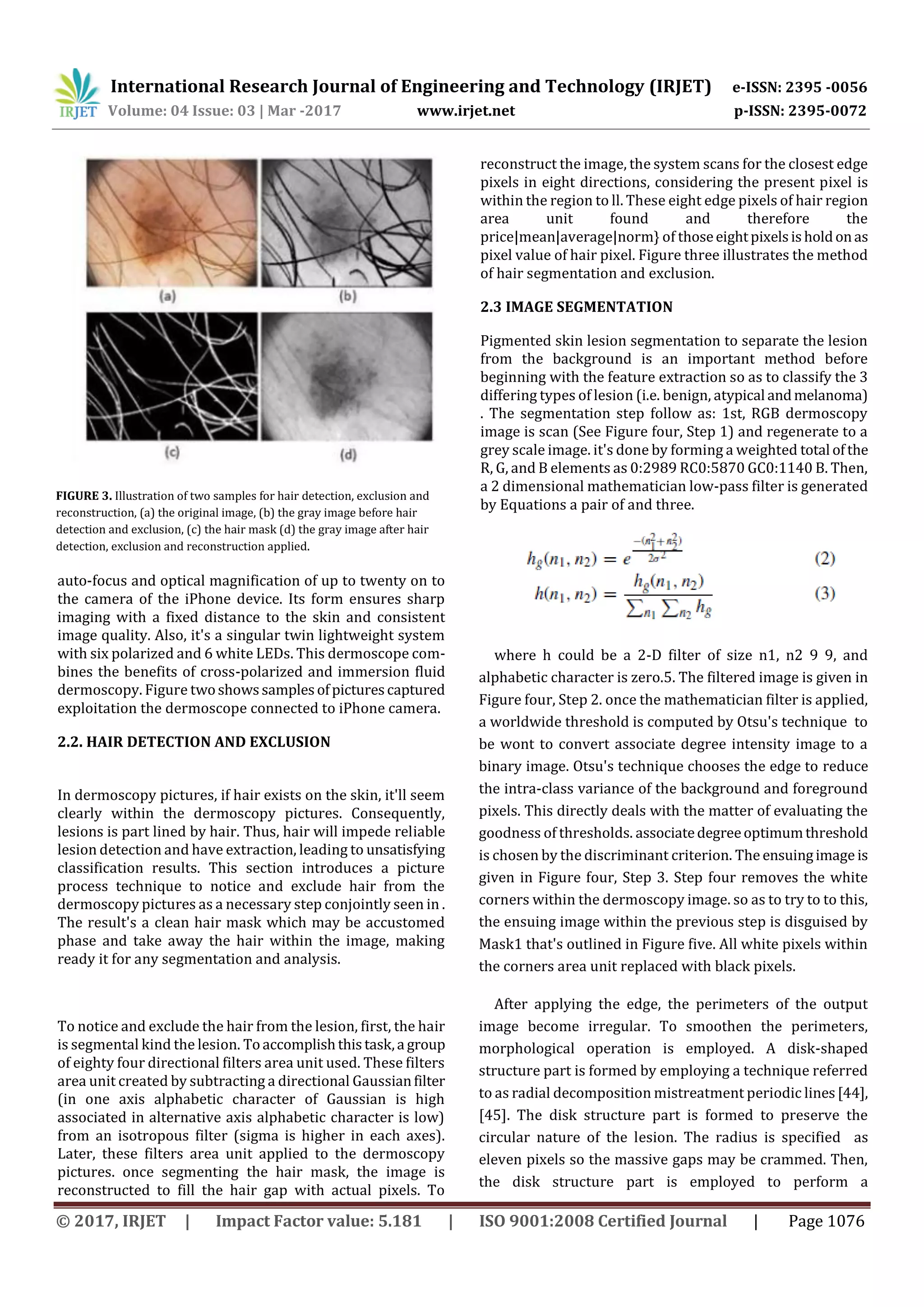 Non-Invasive ABCD Monitoring of Malignant Melanoma Using Image ...