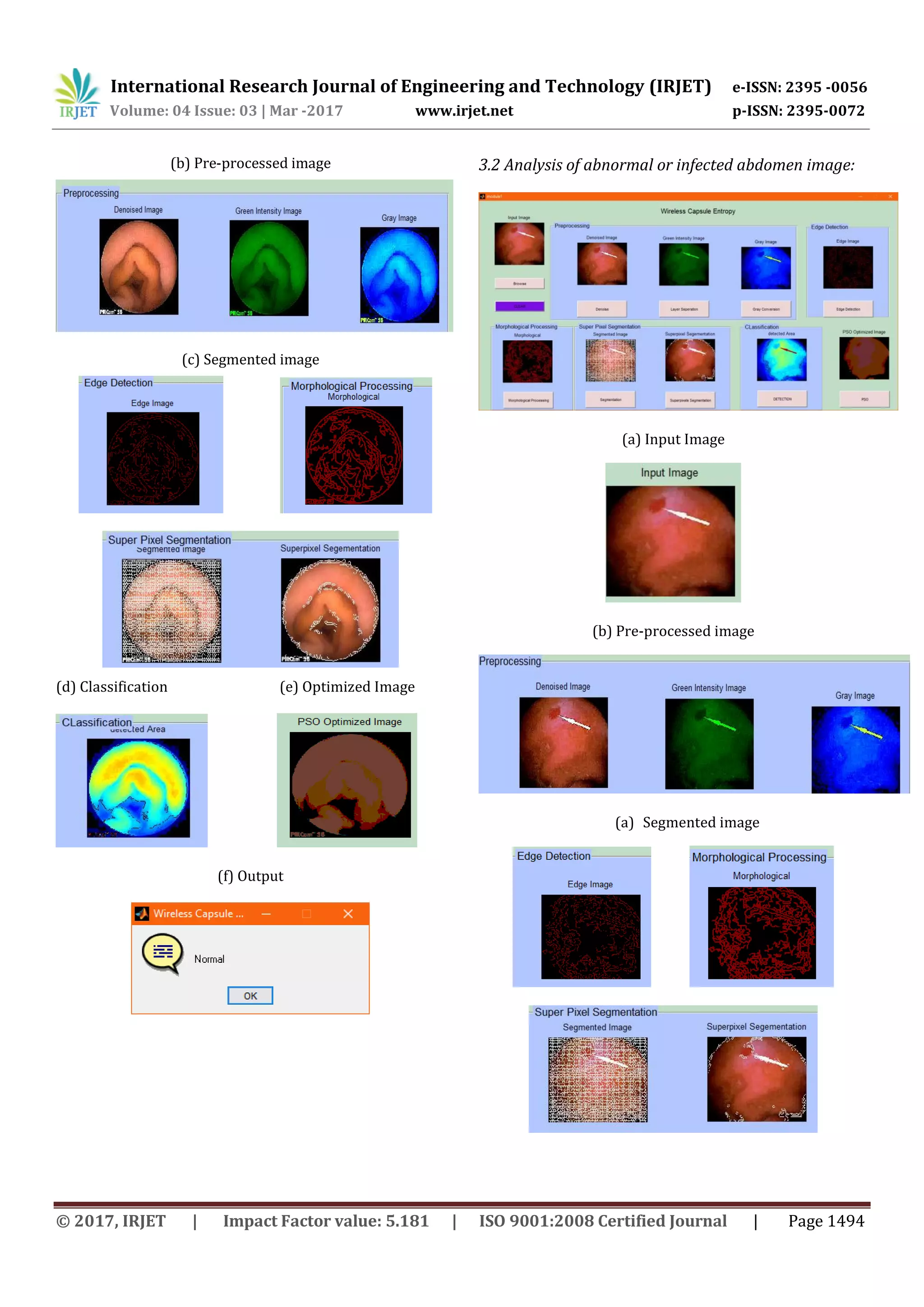 Saliency Based Hookworm And Infection Detection For Wireless Capsule Endoscopy Diagnosis Pdf