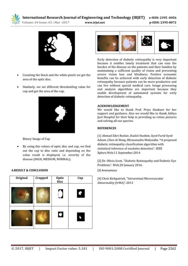 Optical Disc Detection Localization And Glaucoma Identification Of Retinal Fundus Image Pdf