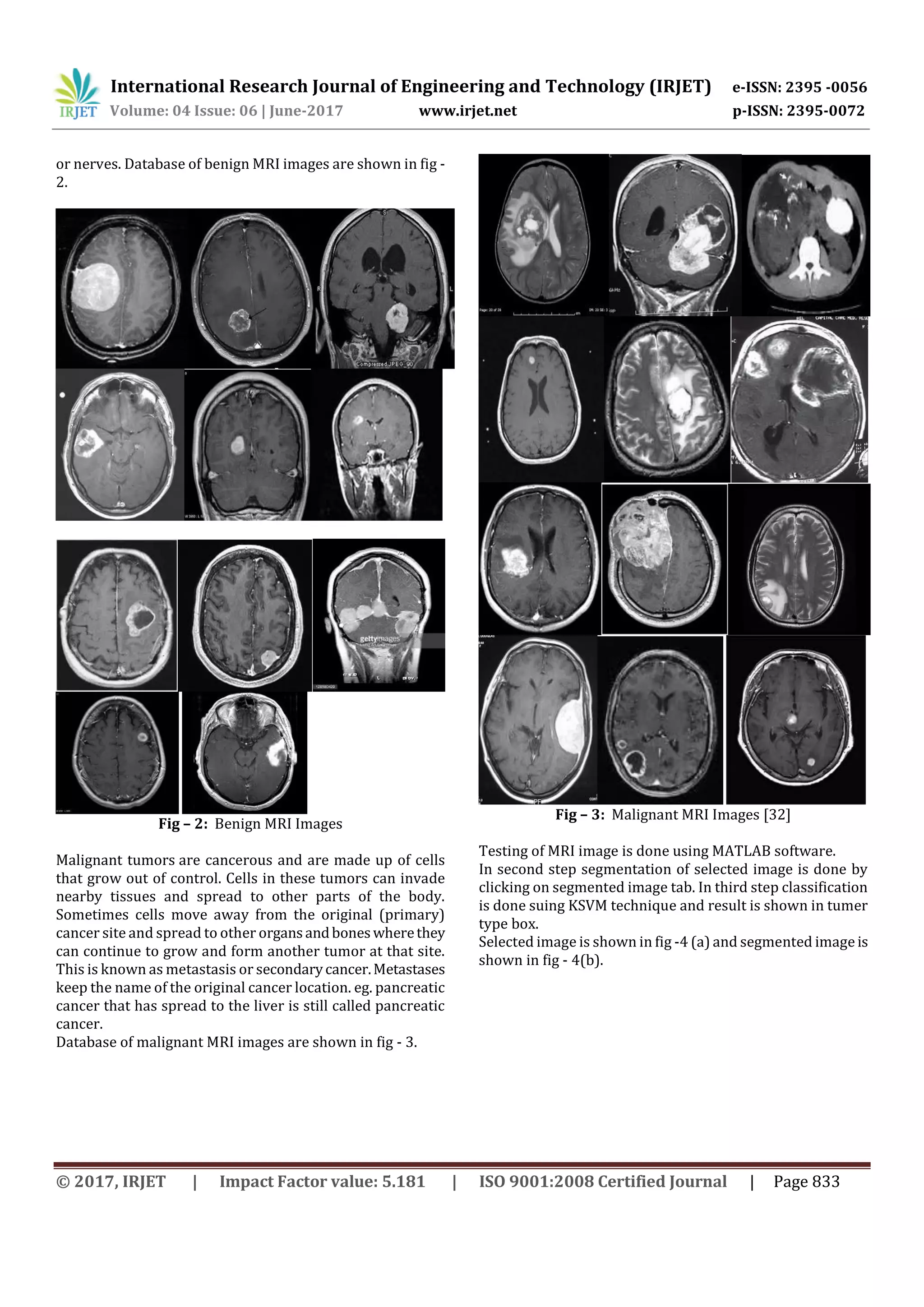 Performance Analysis of SVM Classifier for Classification of MRI Image ...