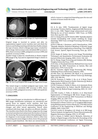 Performance Analysis of SVM Classifier for Classification of MRI Image | PDF