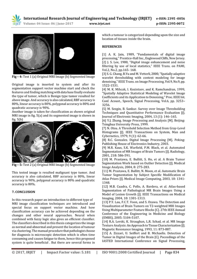 Performance Analysis Of Svm Classifier For Classification Of Mri Image