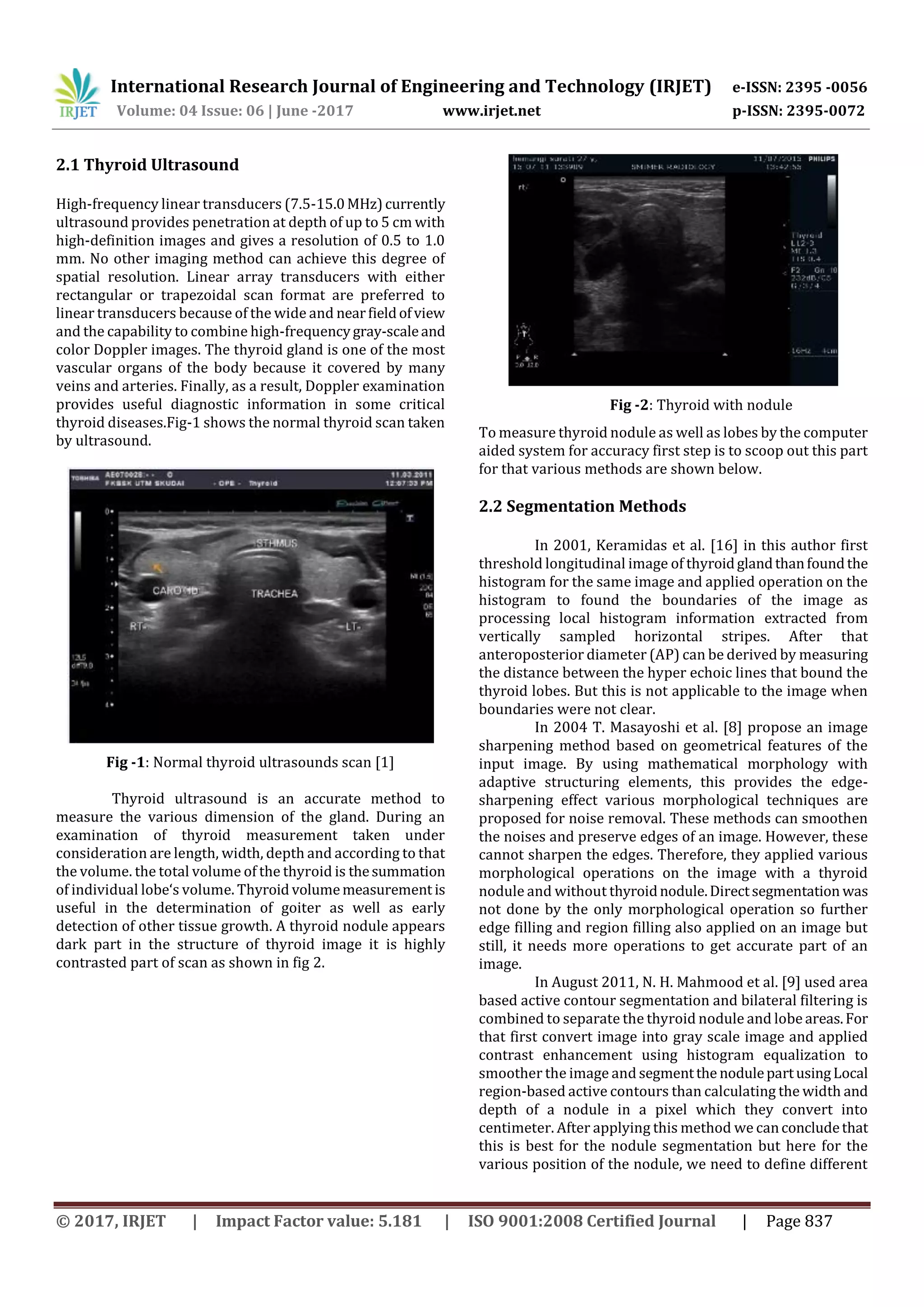 A Review Paper on Various Segmentation Methods used on Ultrasound Images for Thyroid Diagnosis | PDF