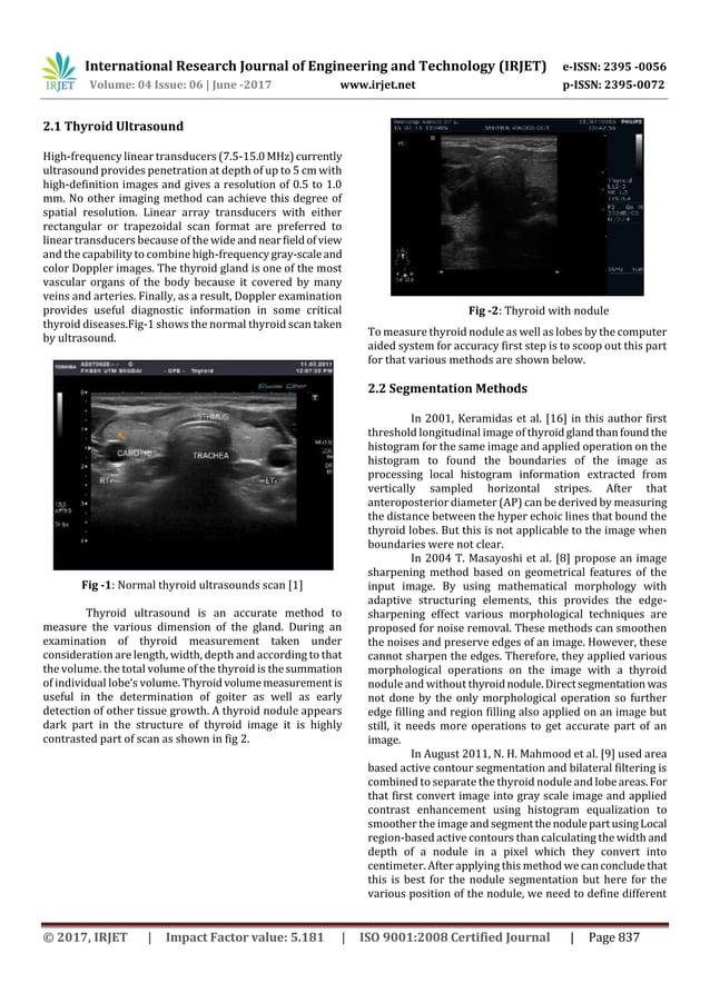 A Review Paper on Various Segmentation Methods used on Ultrasound Images for Thyroid Diagnosis | PDF