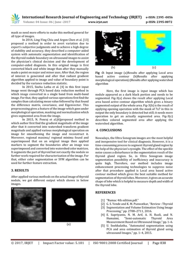 A Review Paper on Various Segmentation Methods used on Ultrasound Images for Thyroid Diagnosis | PDF