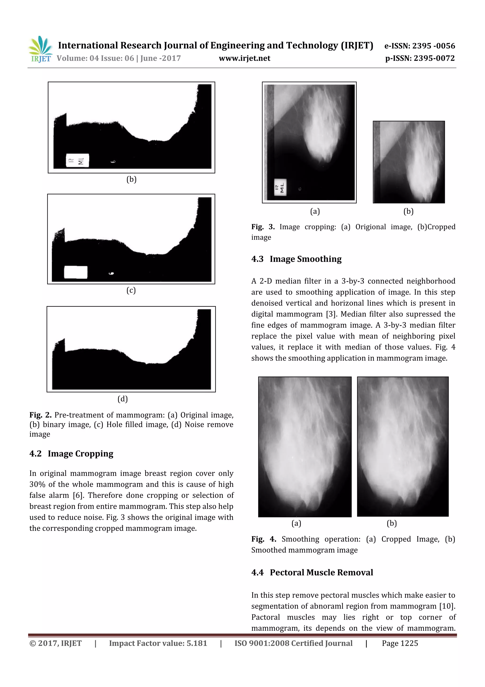 Pre-treatment and Segmentation of Digital Mammogram | PDF