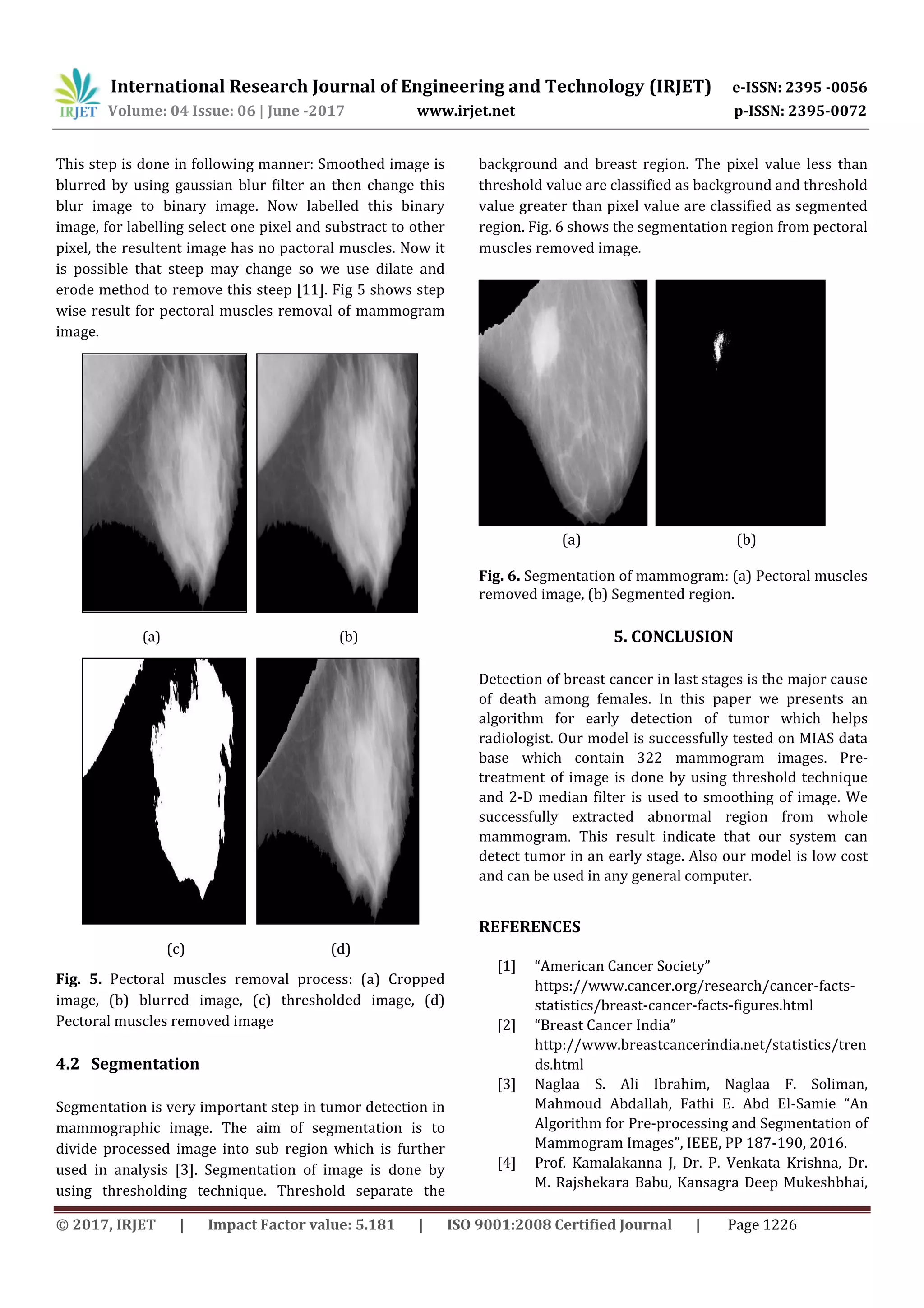 Pre-treatment and Segmentation of Digital Mammogram | PDF