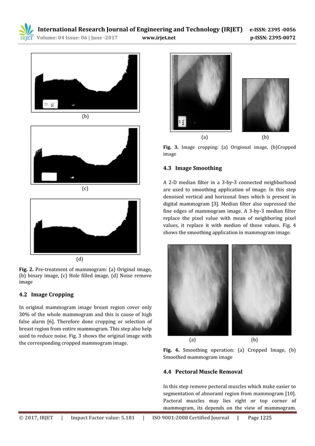 Pre-treatment and Segmentation of Digital Mammogram | PDF
