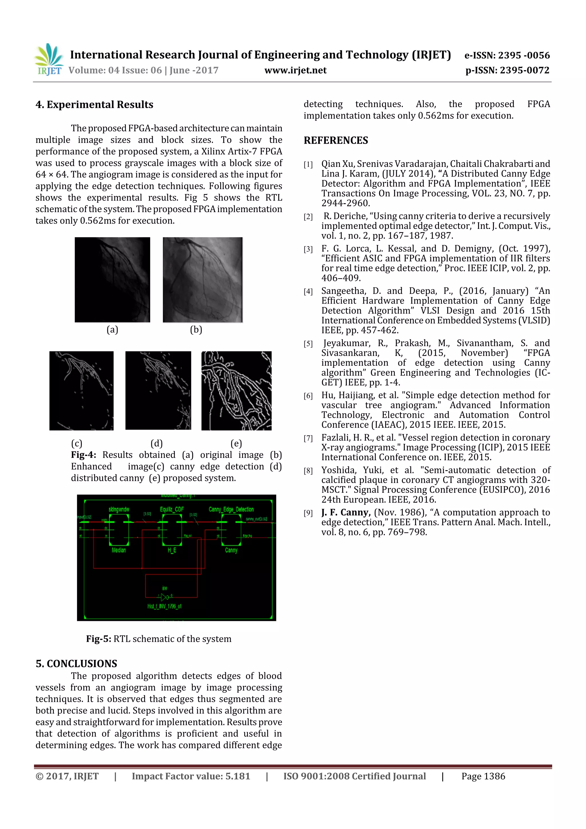 Real Time Implementation Of Ede Detection Technique For Angiogram Images On Fpga Pdf