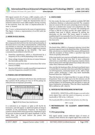 Cardio Logical Signal Processing for Arrhythmia Detection with Comparative Analysis of Q-Factor ...