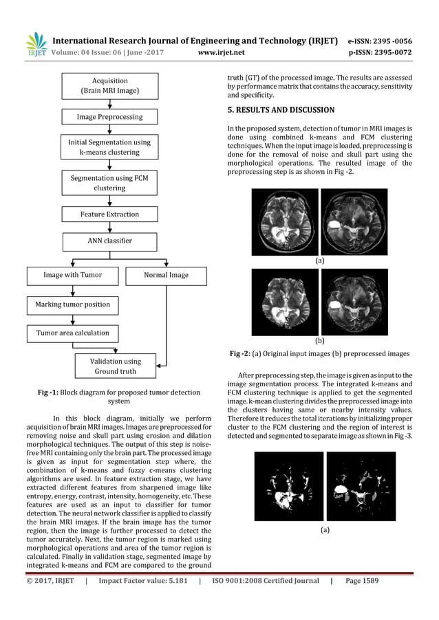 Brain Tumor Detection using Clustering Algorithms in MRI Images | PDF