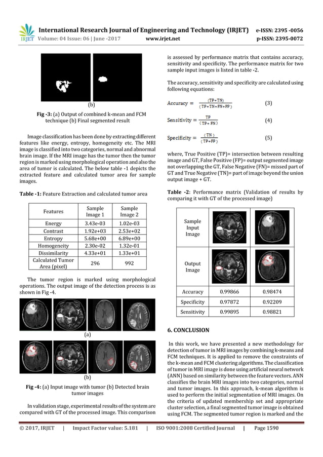 Brain Tumor Detection using Clustering Algorithms in MRI Images | PDF