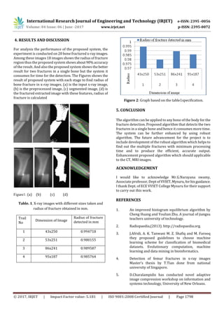 Automatic Detection of Radius of Bone Fracture | PDF