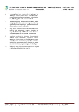Automatic Detection of Radius of Bone Fracture | PDF