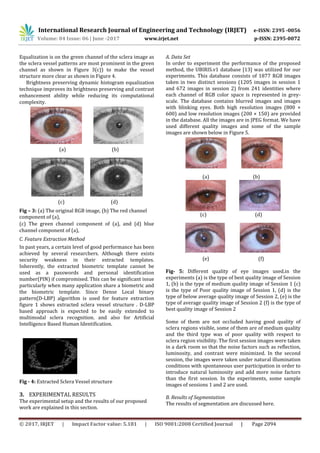 Human Identification Based on Sclera Veins Extraction | PDF