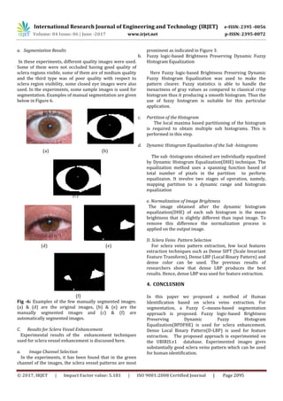 Human Identification Based on Sclera Veins Extraction | PDF