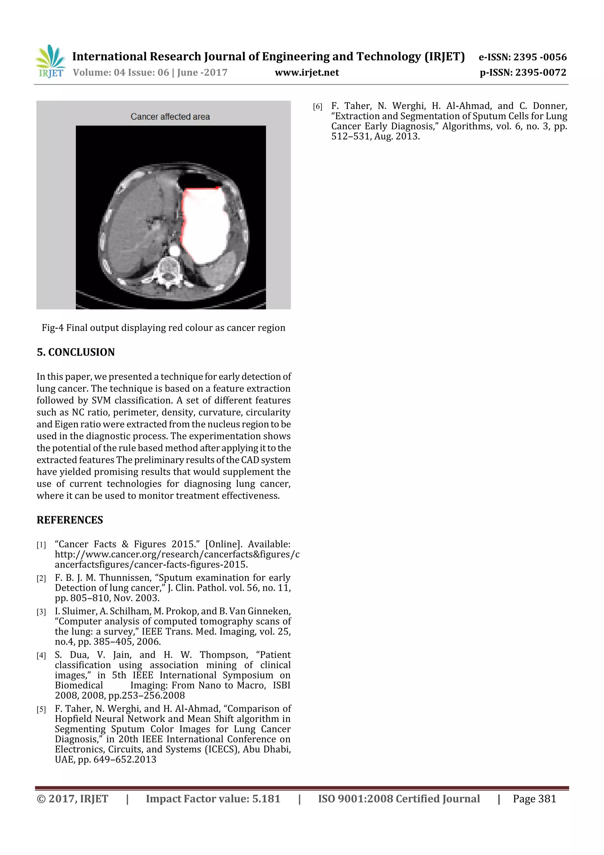 Detection Of Lung Cancer Using Svm Classification Pdf