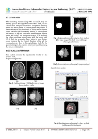 Segmentation and Classification of MRI Brain Tumor | PDF