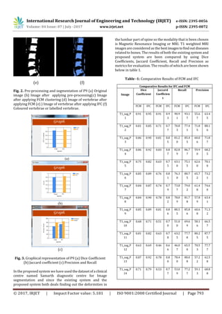 Intuitionistic Fuzzy Clustering Based Segmentation of Spine MR Images | PDF