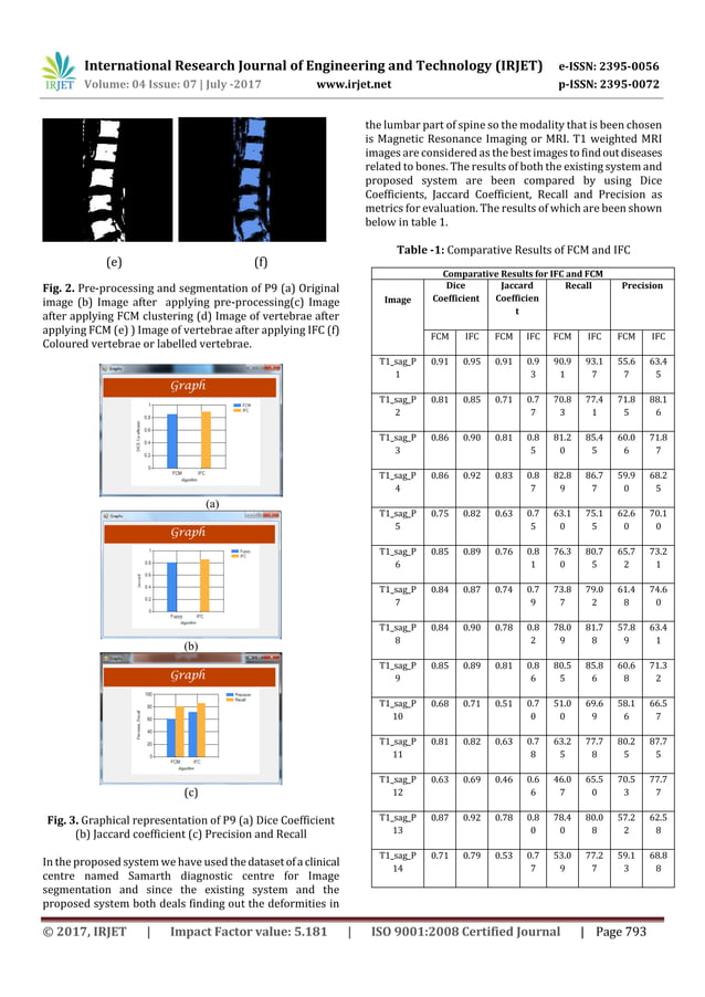 Intuitionistic Fuzzy Clustering Based Segmentation of Spine MR Images | PDF