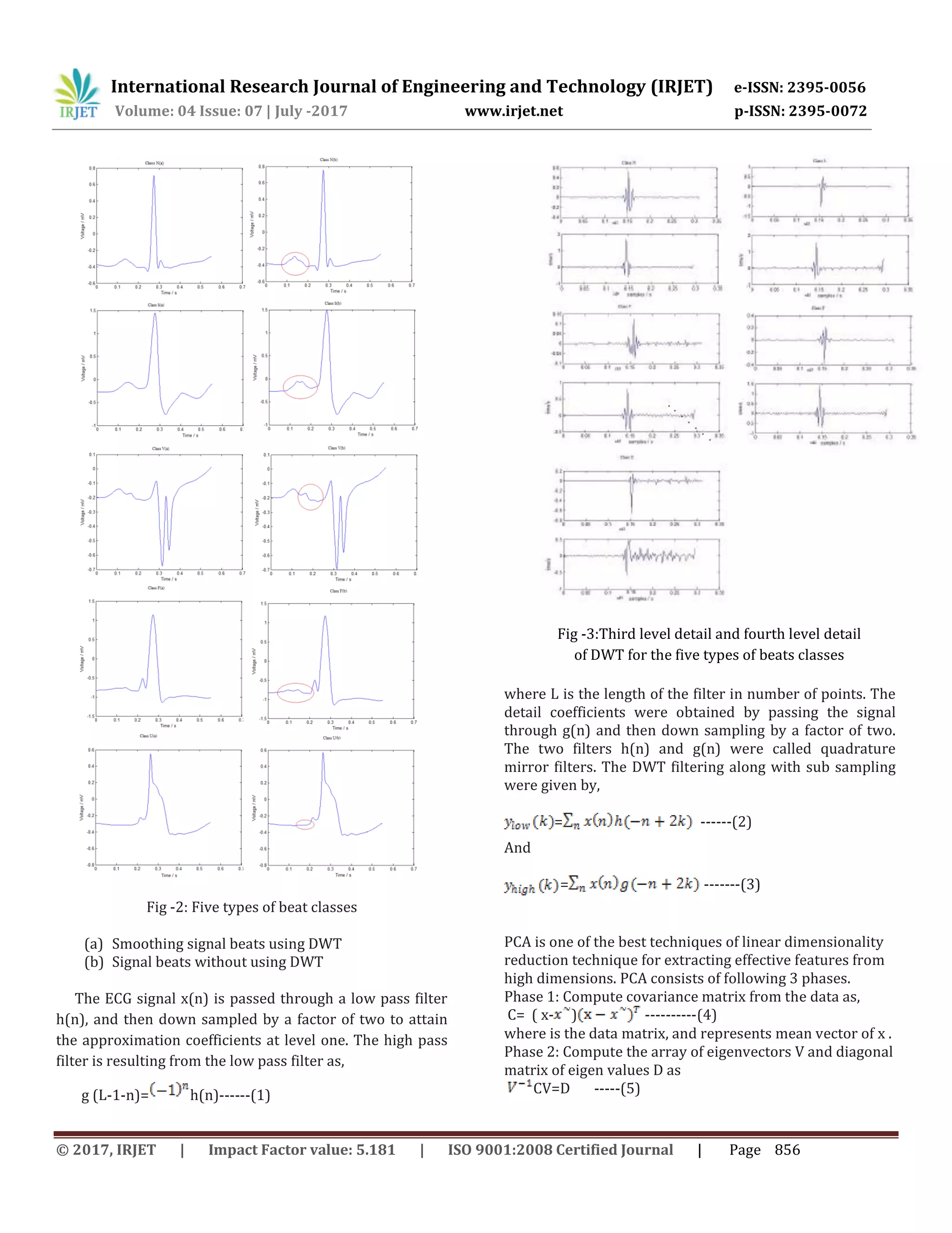 Electrocardiogram Beat Classification Using Discrete Wavelet Transform