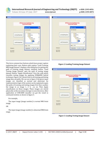 SVM-KNN Hybrid Method for MR Image | PDF