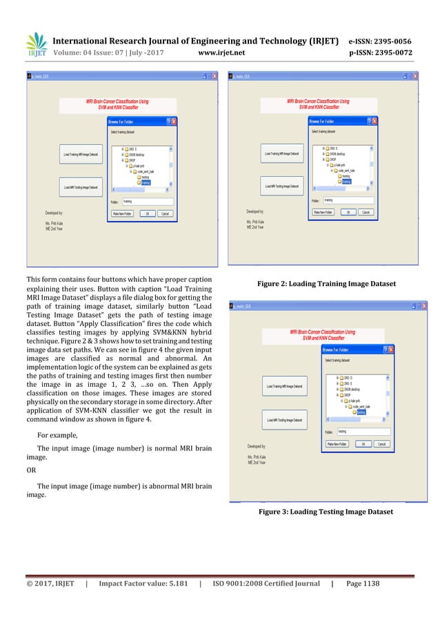 SVM-KNN Hybrid Method for MR Image | PDF | Medical Tests | Medical Health