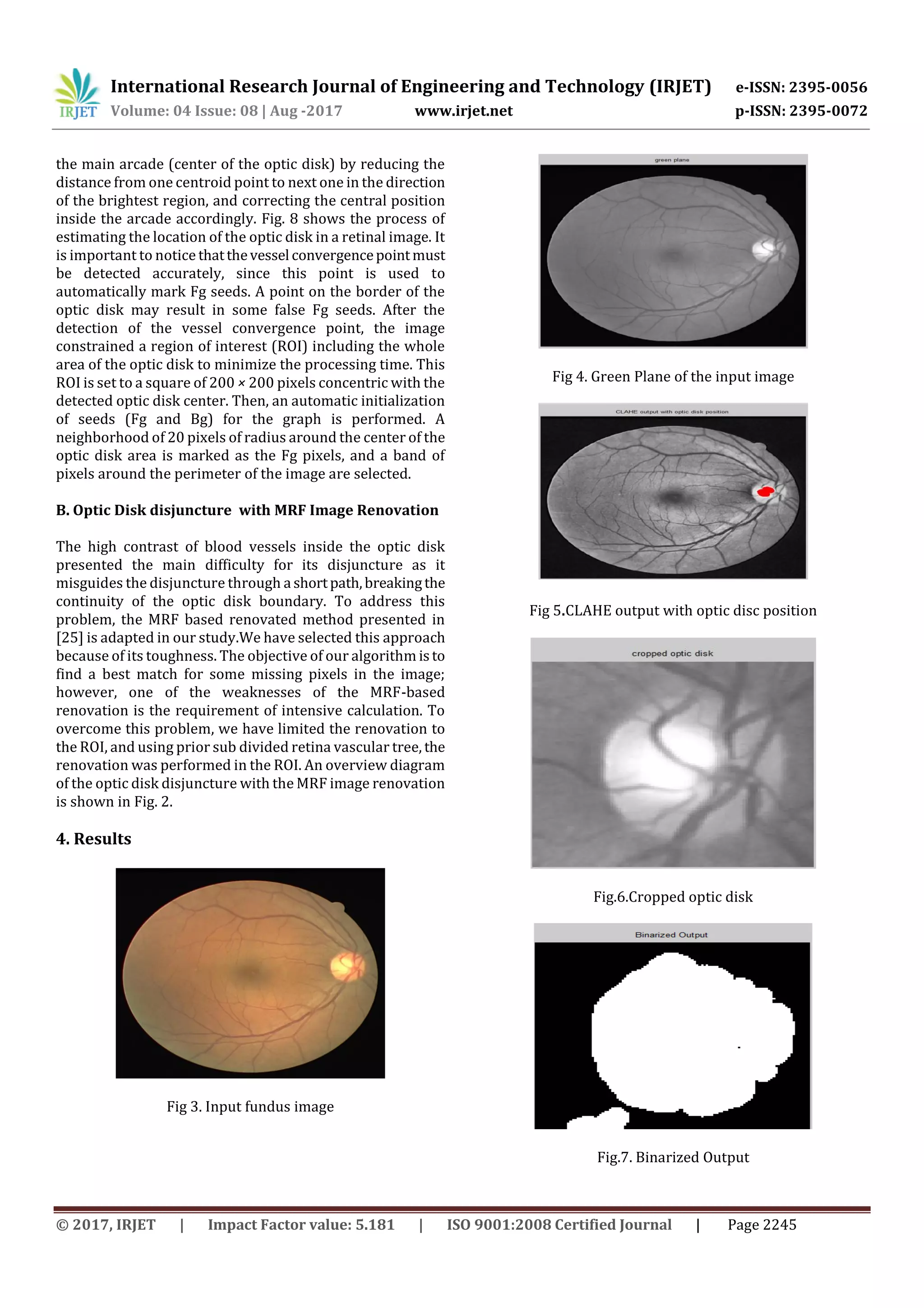 Optic Disk and Retinal Vesssel Segmentation in Fundus Images | PDF