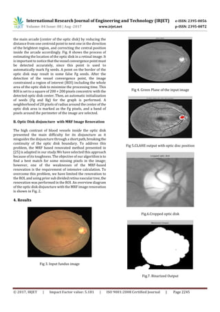 Optic Disk and Retinal Vesssel Segmentation in Fundus Images | PDF