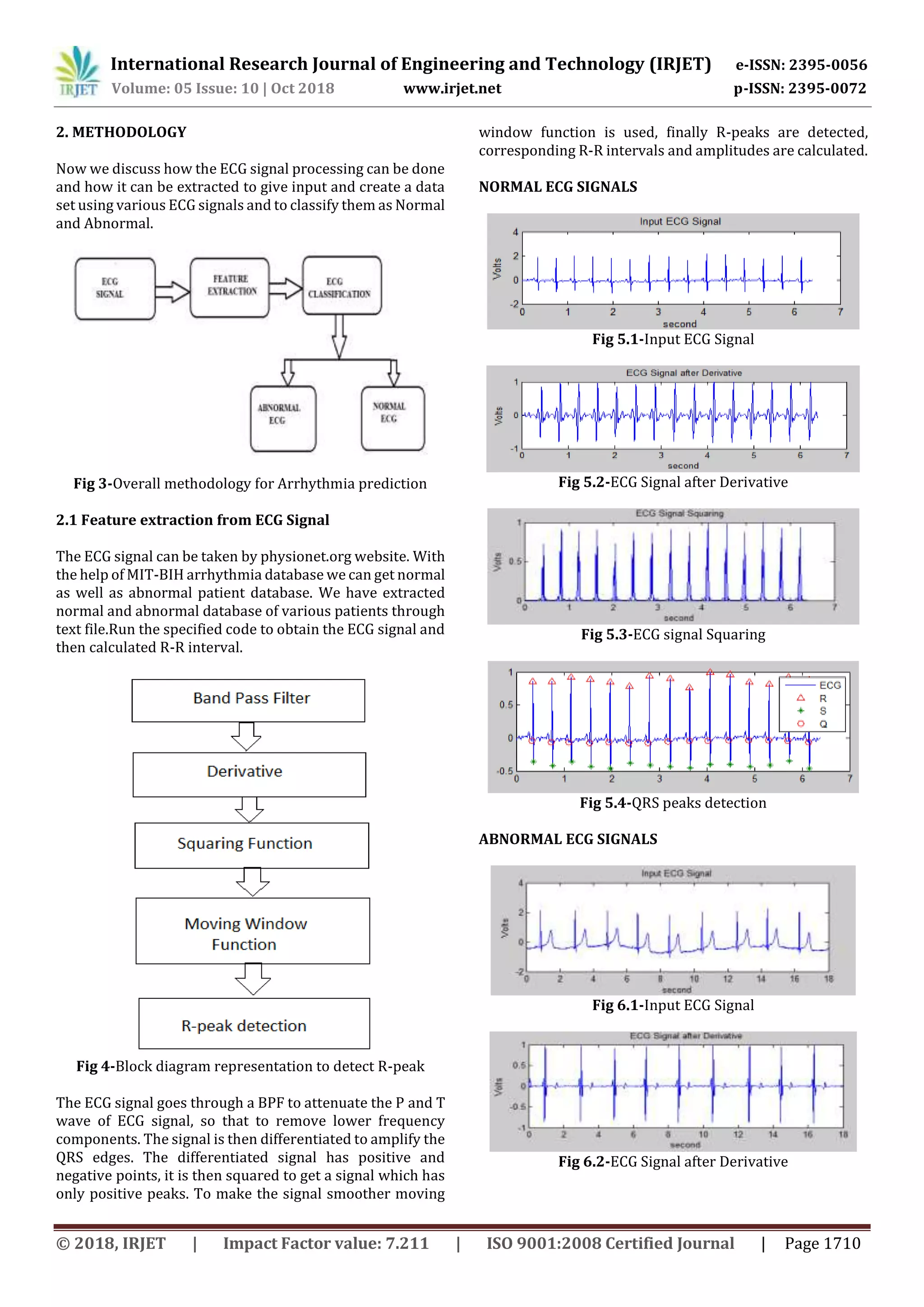 Irjet Classification Of Arrhythmic Ecg Data Using Artificial Neural Network Pdf 8350