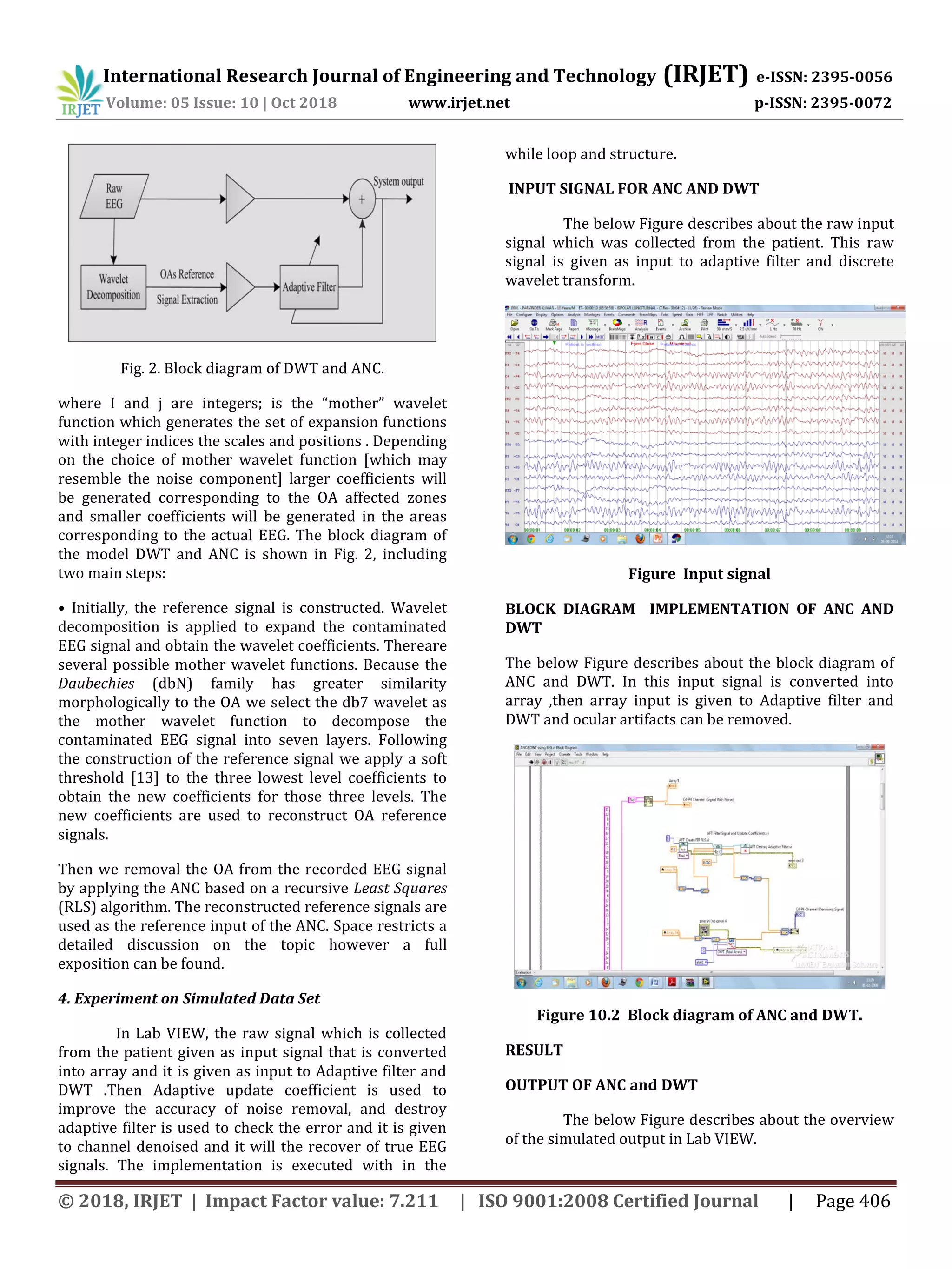 IRJET- An Efficient Approach for Removal of Ocular Artifacts in EEG-Brain Computer Interface ...