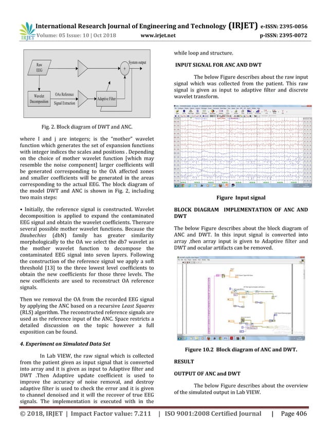 IRJET- An Efficient Approach for Removal of Ocular Artifacts in EEG-Brain Computer Interface ...