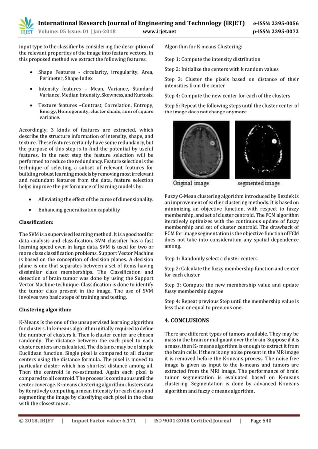 IRJET-A Review on Brain Tumor Detection using BFCFCM Algorithm | PDF