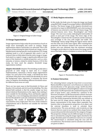 IRJET- A New Strategy to Detect Lung Cancer on CT Images | PDF