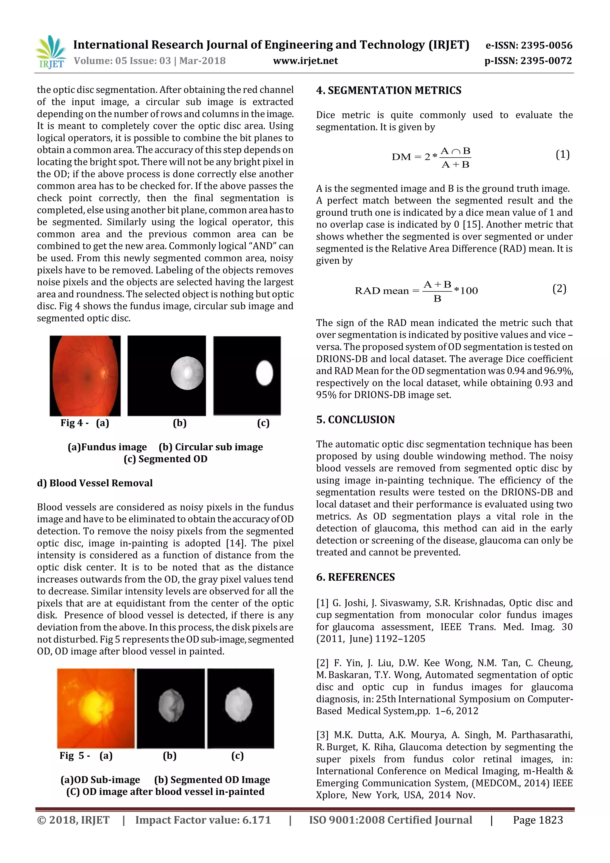 IRJET- Segmentation of Optic Disc using Bit Plane Technique for Glaucoma Screening | PDF | Eye ...
