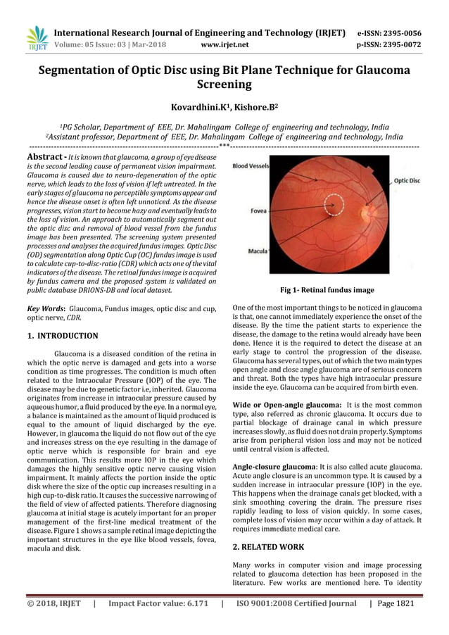IRJET- Segmentation of Optic Disc using Bit Plane Technique for Glaucoma Screening | PDF | Eye ...