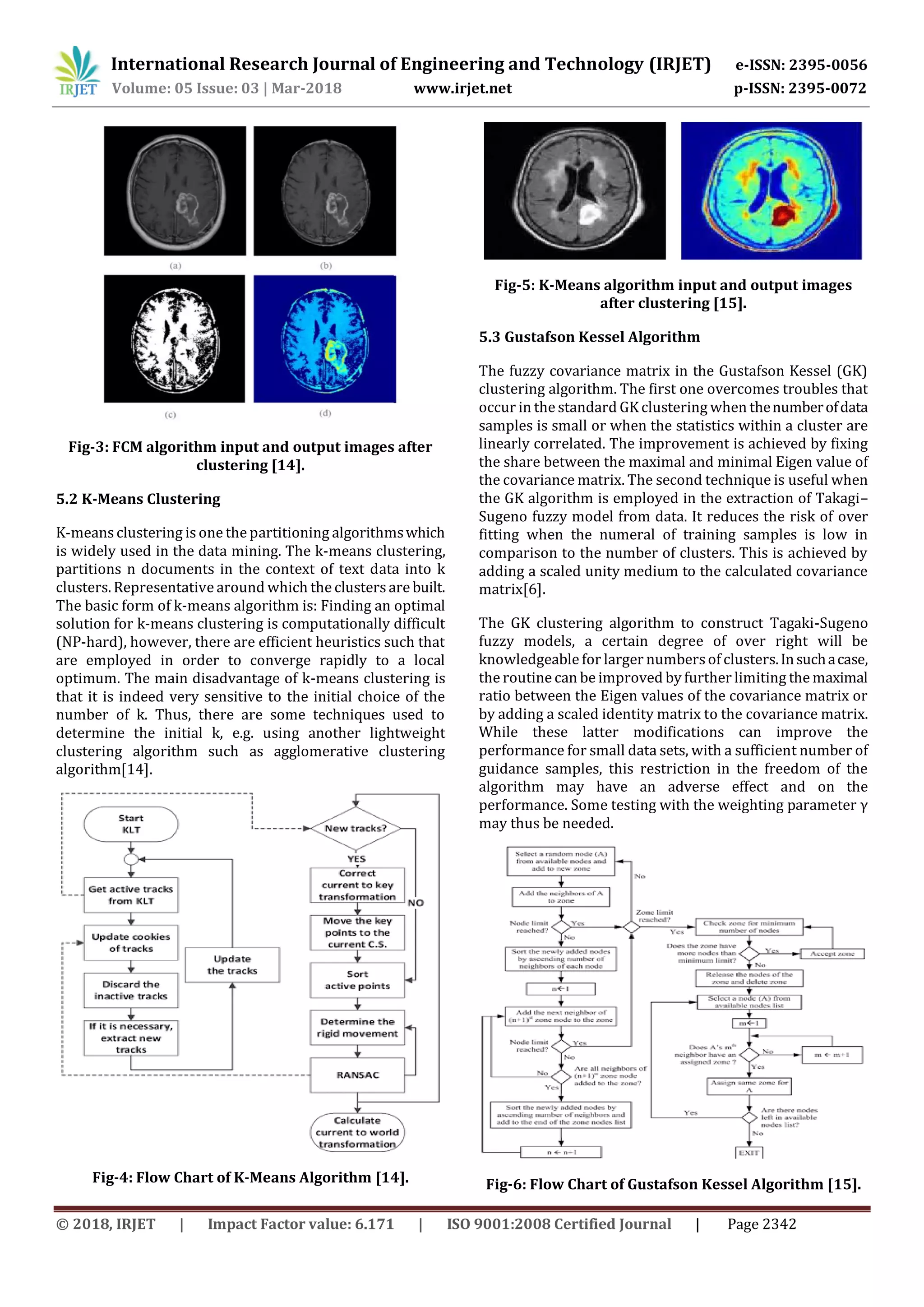 Irjet Analysis Of Brain Tumor Classification By Using Multiple Clustering Algorithms Pdf
