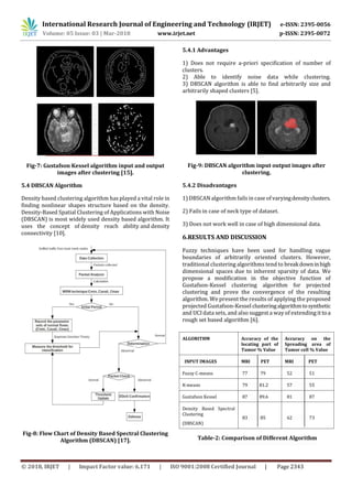 IRJET- Analysis of Brain Tumor Classification by using Multiple Clustering Algorithms | PDF ...