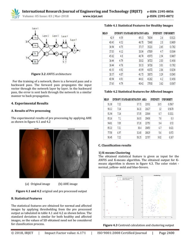 Irjet Detection Of Cataract By Statistical Features And Classification