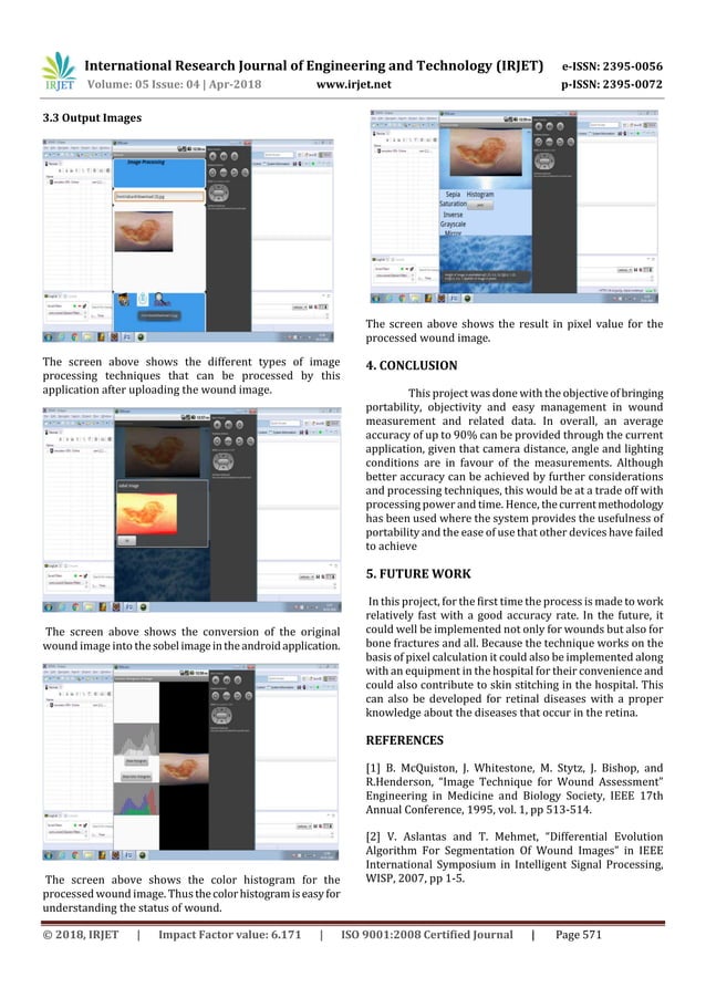 IRJET- Analysing Wound Area Measurement using Android App | PDF