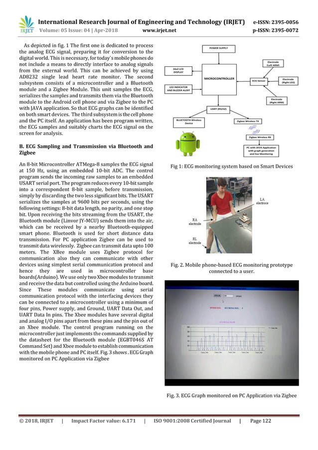 IRJET- Design and Implementation of Low Cost Ecg Monitoring System using Smart Devices (Mobile ...