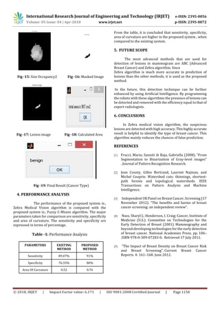 IRJET- Detection of Suspicious Lesions in Mammogram using Zebra Medical Vision Algorithm | PDF ...